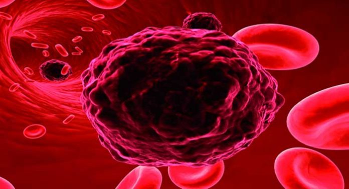 Coágulo de sangre: todo lo que necesitas saber